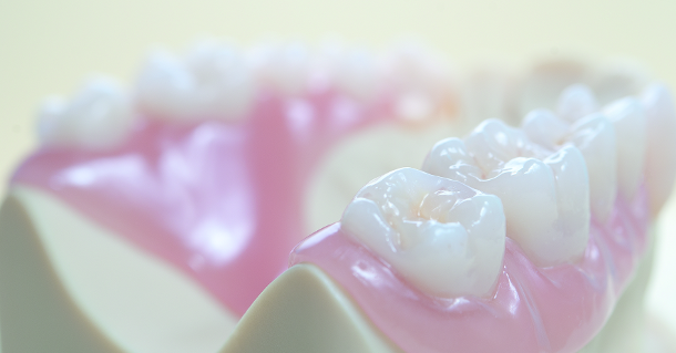 Dental News - Thermoplastic materials in dental technology
