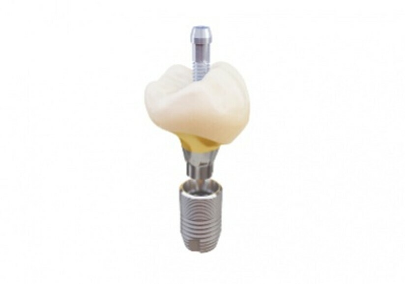 Dentsply Sirona – Atlantis CustomBase