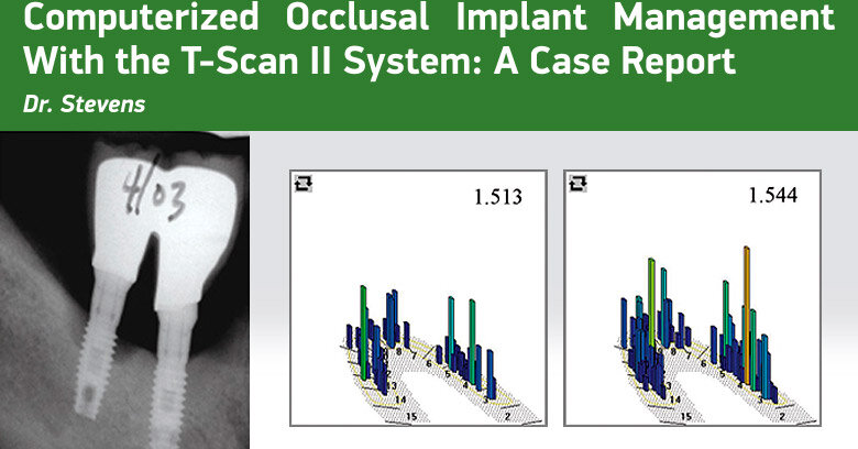 DT News - Greece - Computerized Occlusal Implant Management With the T ...