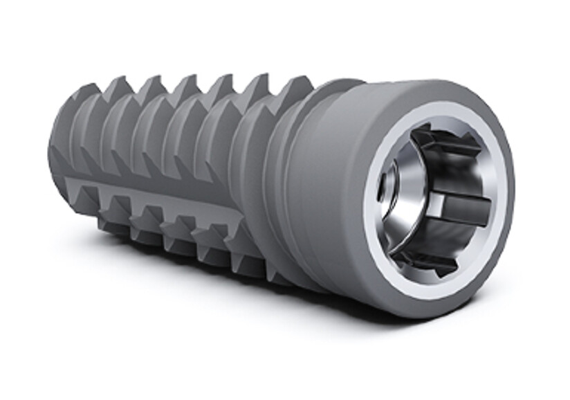 Neoss – ProActive Edge