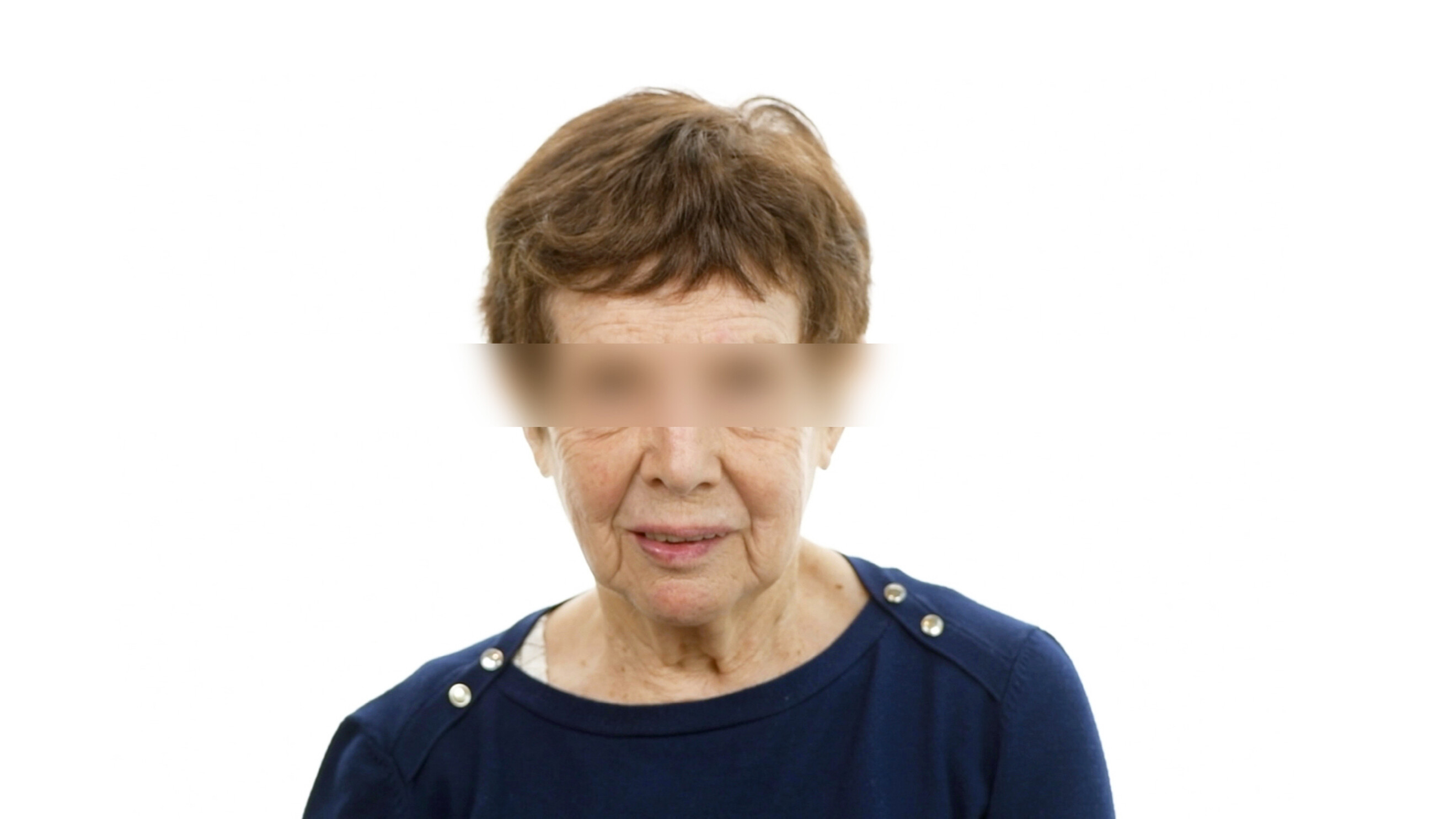 Implant treatment of the fully edentulous patient