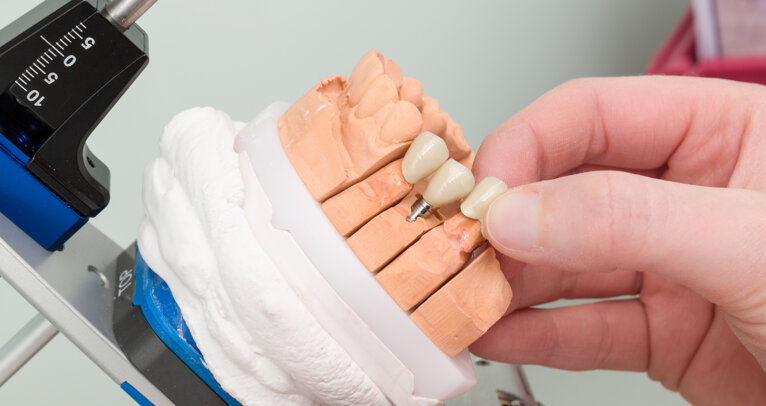 Dental implant system Straumann BLX now available in Europe