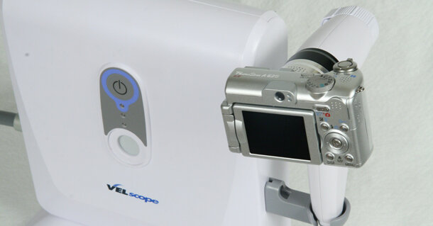 Dental News - World Health Organization honors oral cancer screening device