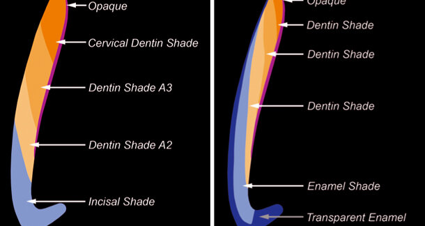 Simple layering technique with direct composite restorations