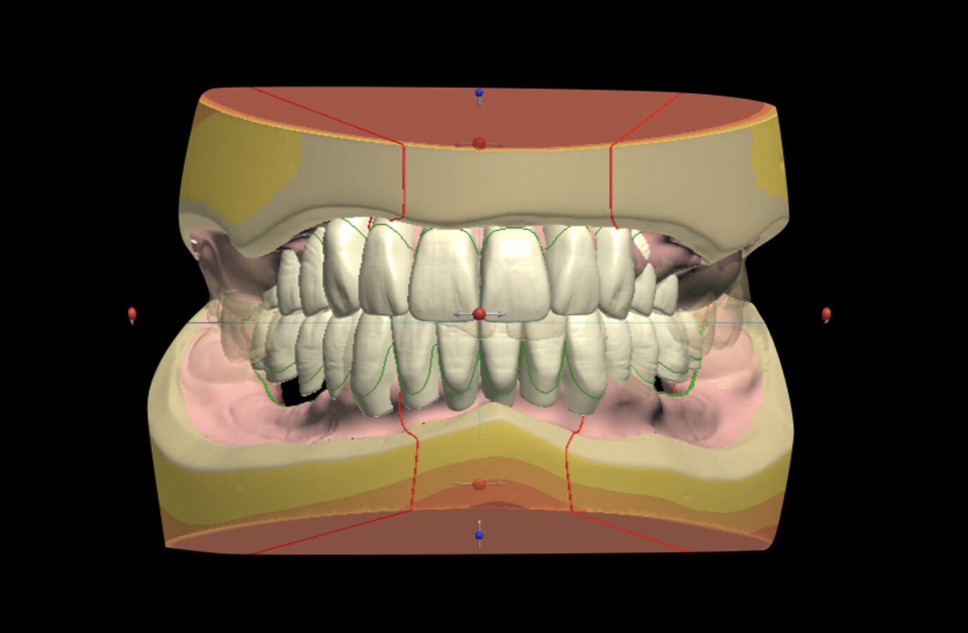 Ivoclar – Digital Denture CAD software