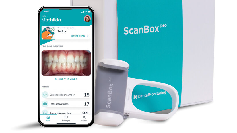 DentalMonitoring launches ScanBox Pro