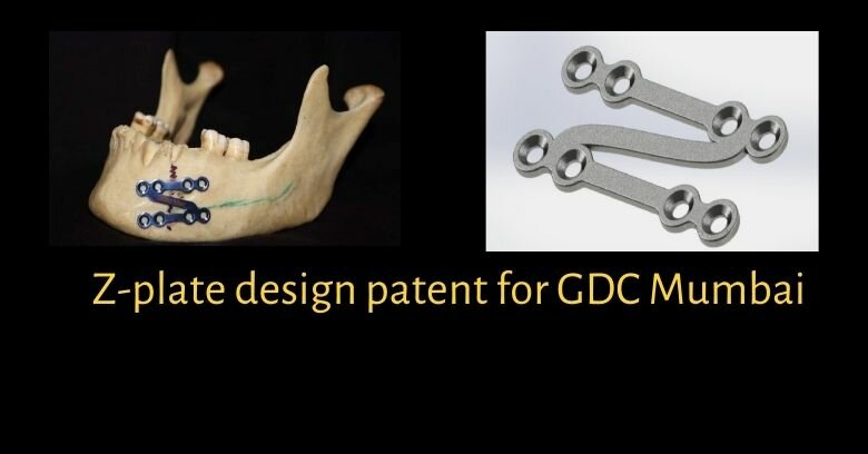"Z-plate for mandibular fractures"- Design patent for Dr Kende & team ...