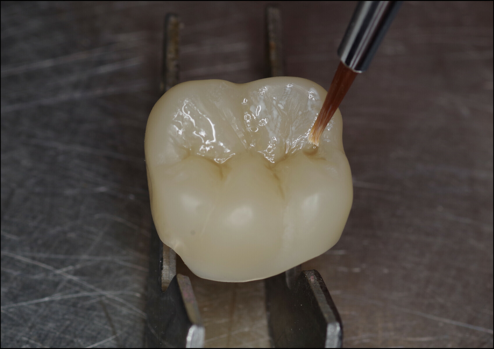 Chairside fabrication of an endocrown