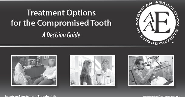 Dental News - Endodontics before extraction: AAE resource illustrates ...