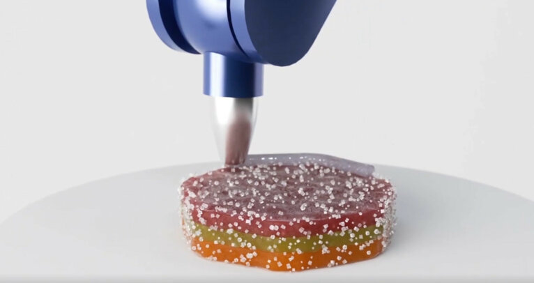 Graphy Presents First Direct 3d Printed Aligner