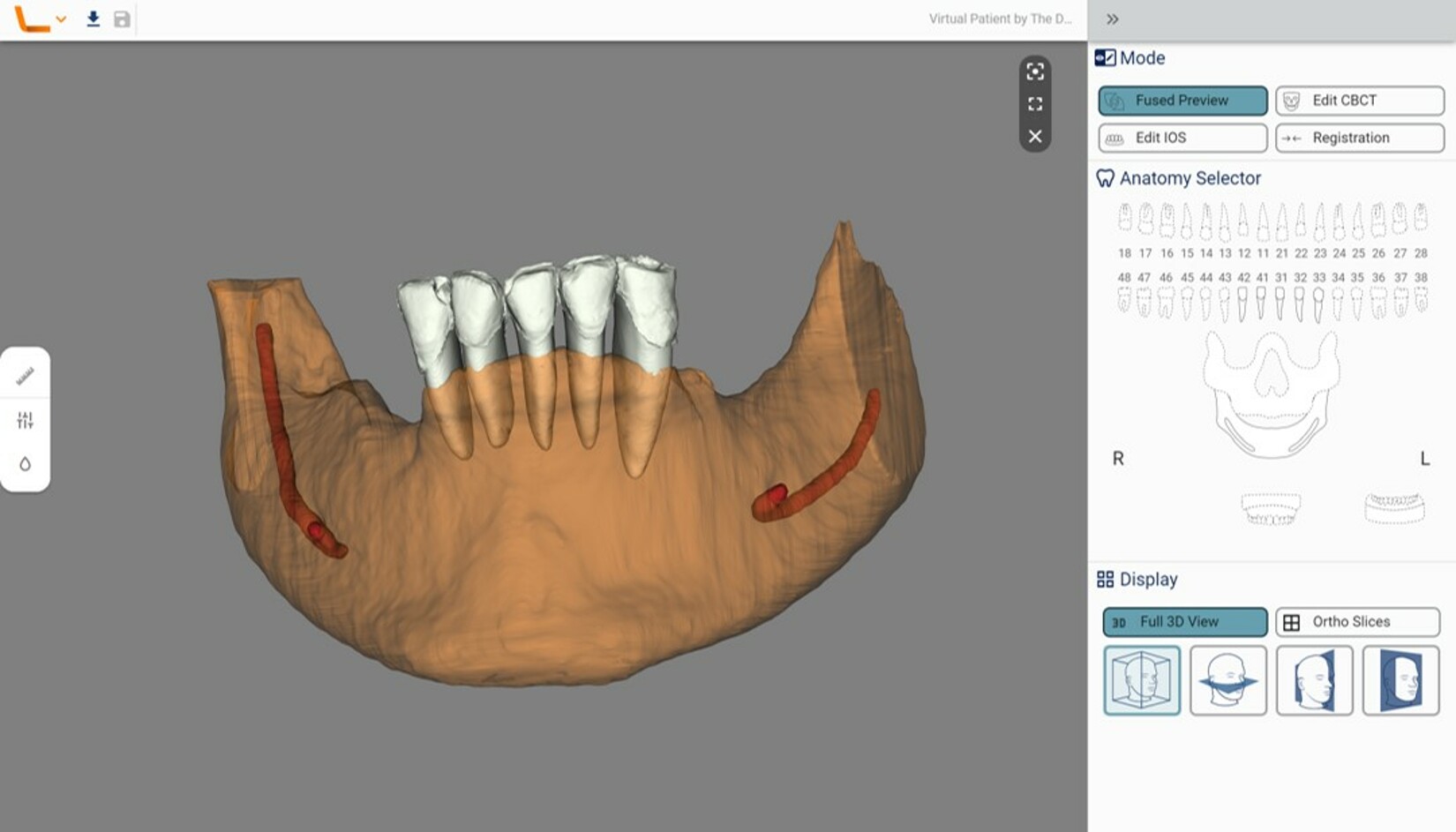 Dental News - Artificial intelligence and augmented reality in implant ...