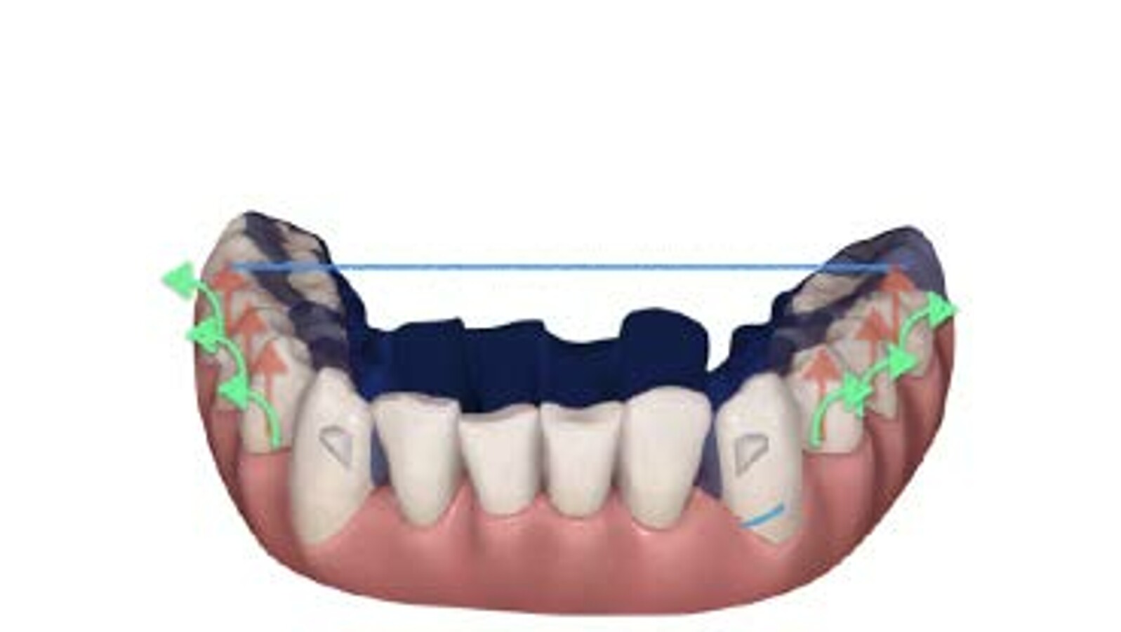 Proper curve of Spee levelling