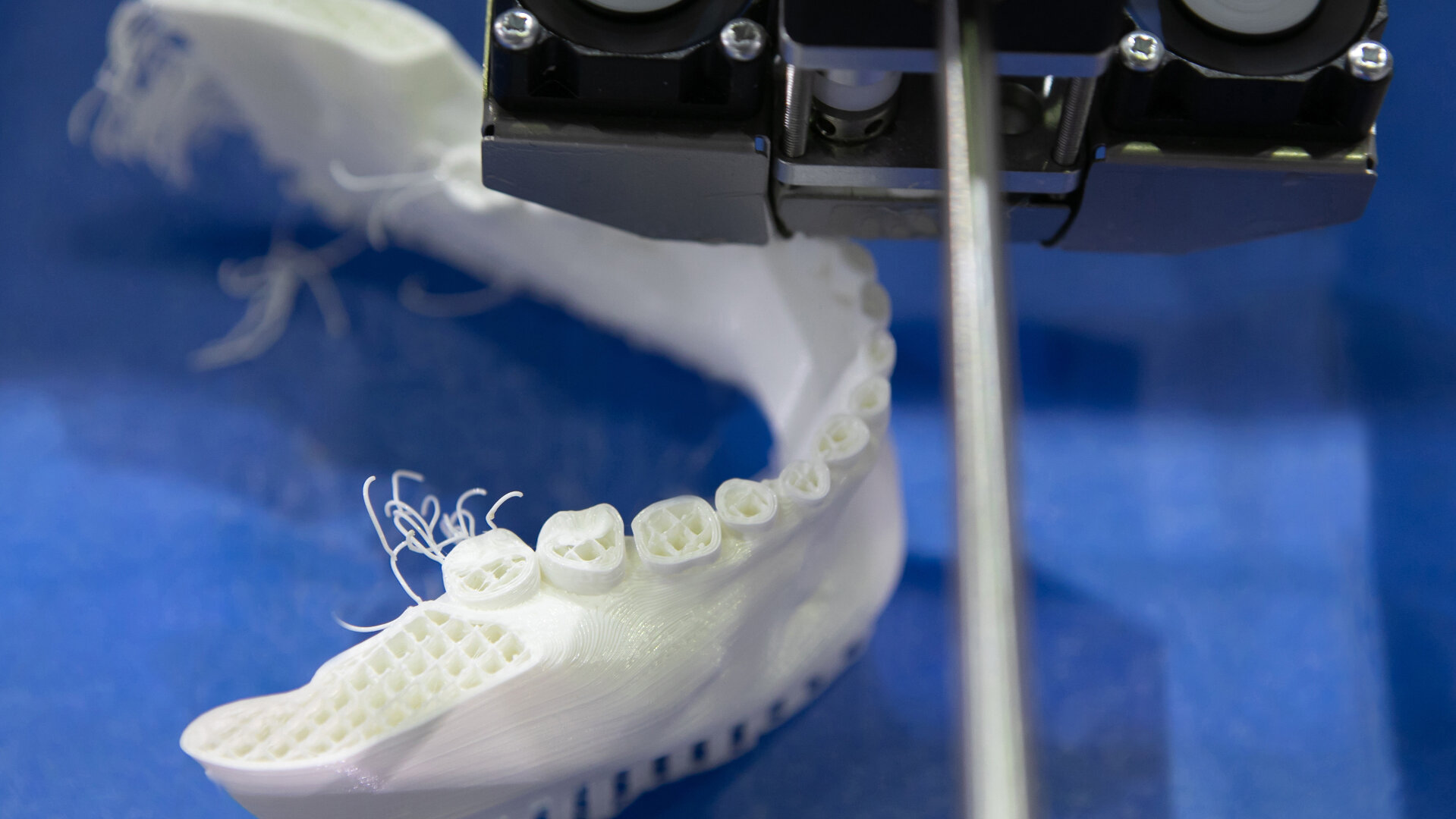The state of 3D printing in implantology
