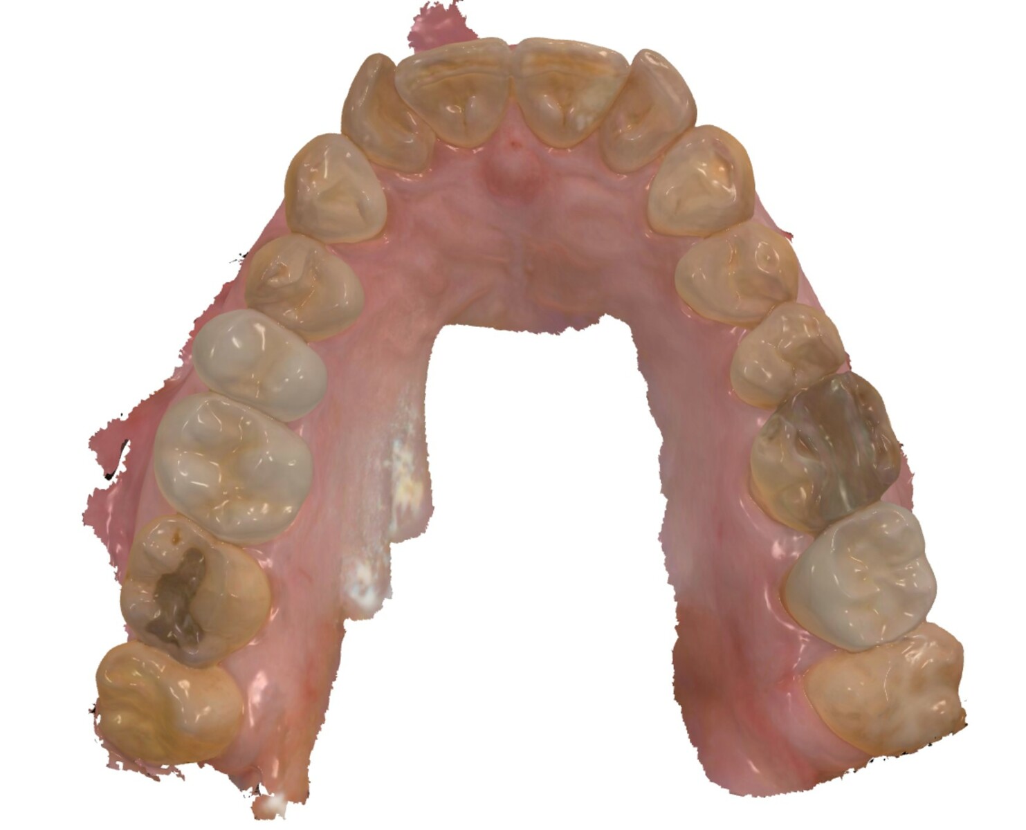 Intra-oral scanners in the dental office