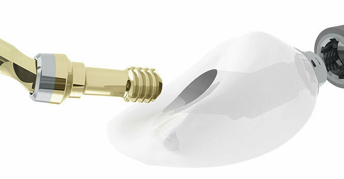 Angulated Screw Access Solution