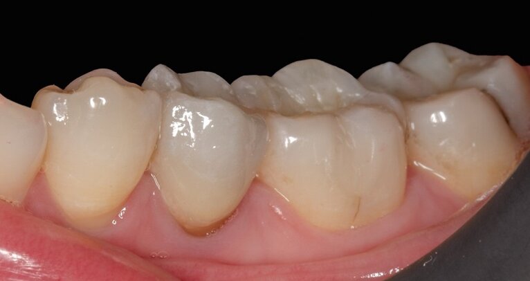 Japanese Government Awards Makoto Nakao Order Of The Rising Sun