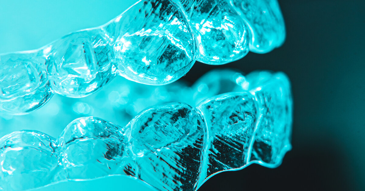 Global clear aligner market: The stars are aligned