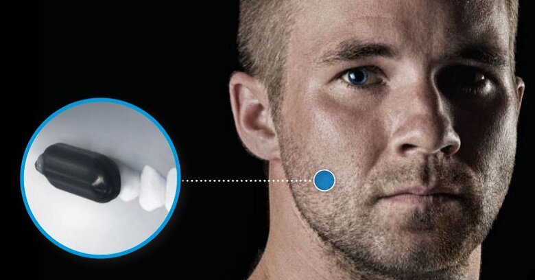 Dental News - “Molar Mic” personal communication system receives ...