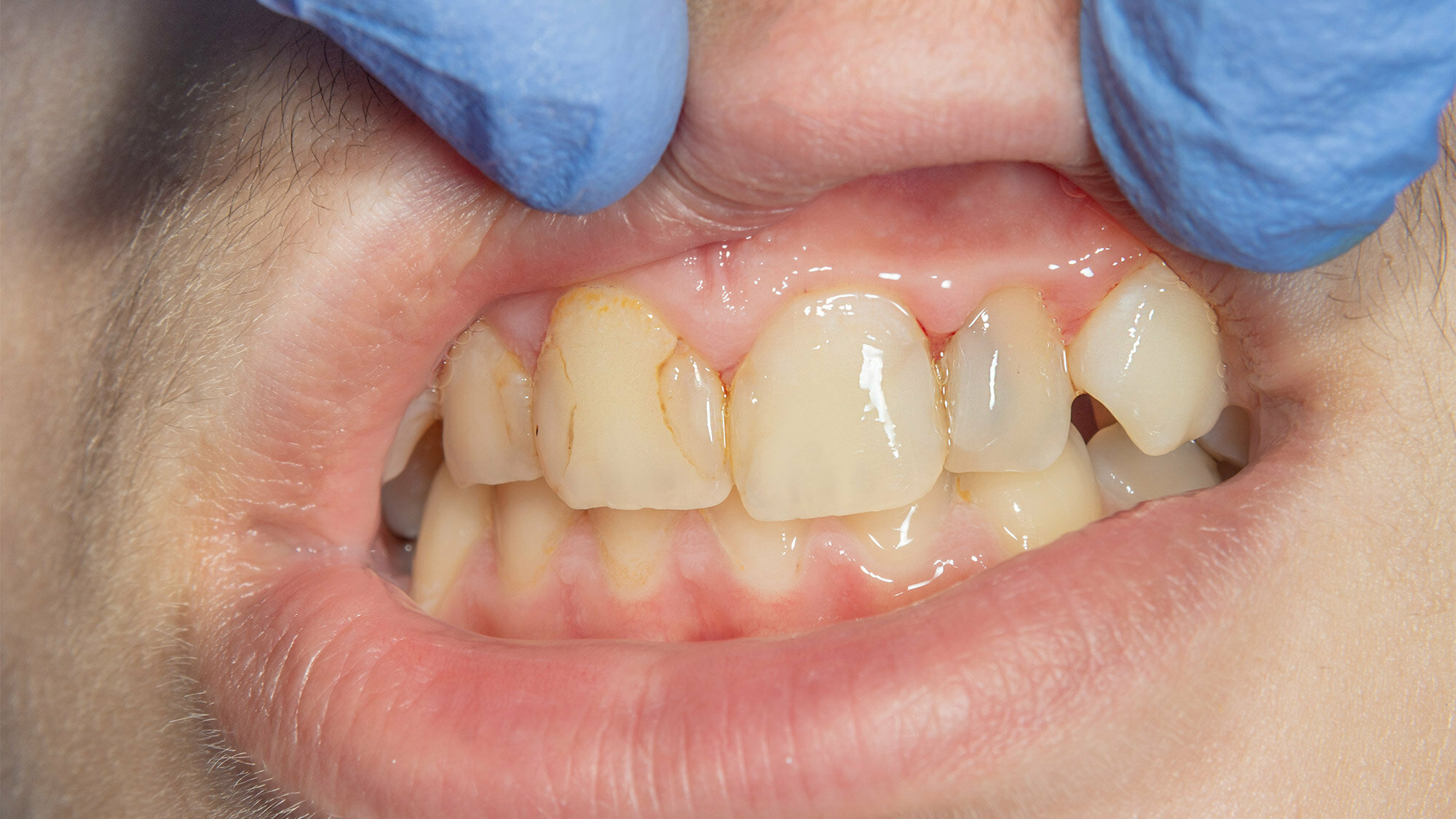 Colgate Oral Health Network