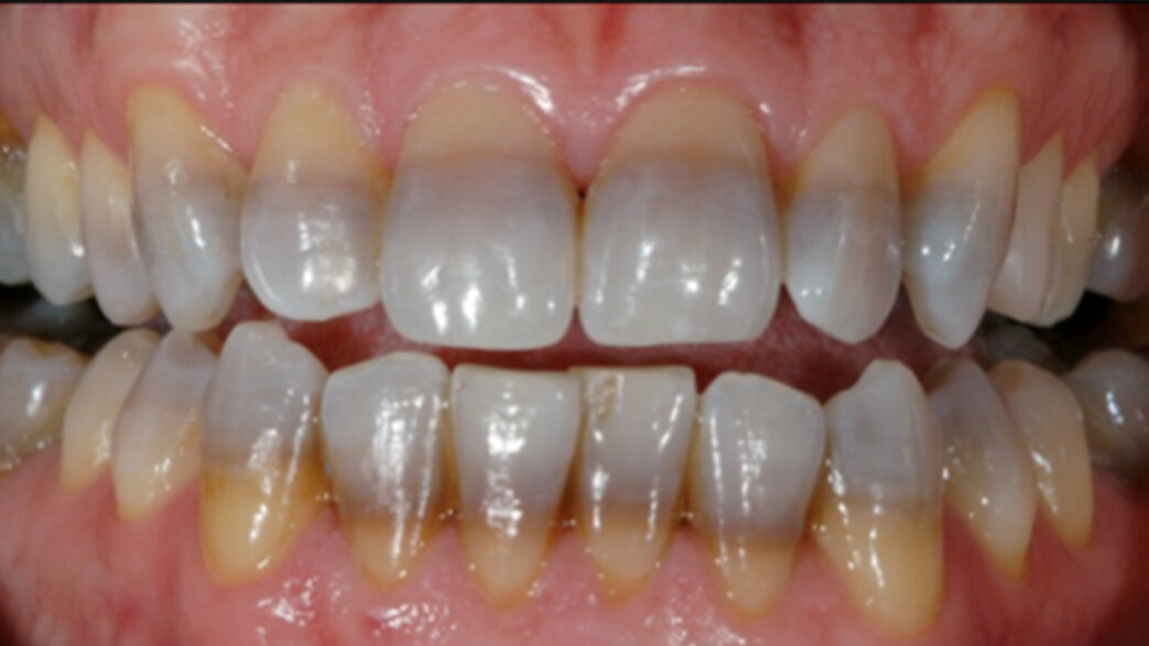 Colgate Oral Health Network