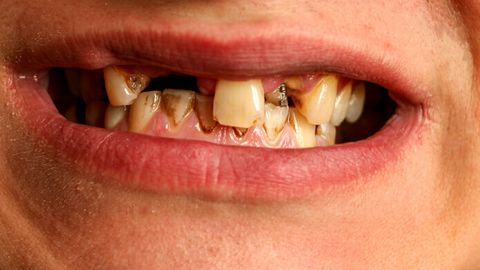 Colgate Oral Health Network