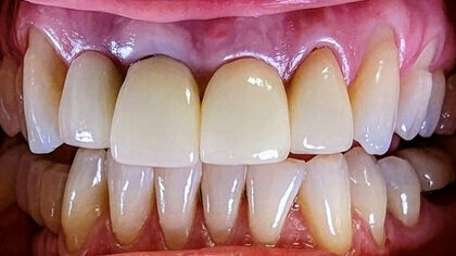 Colgate Oral Health Network