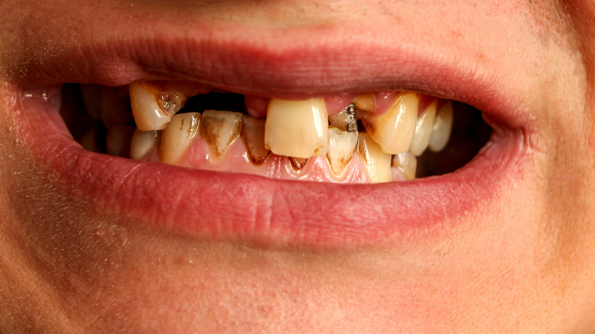 Colgate Oral Health Network