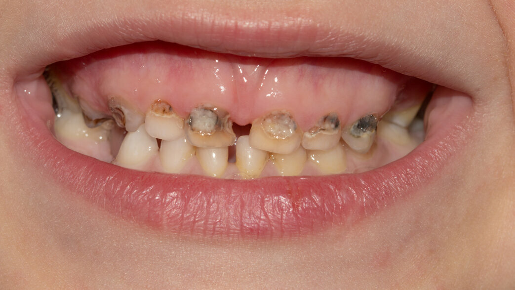 Colgate Oral Health Network